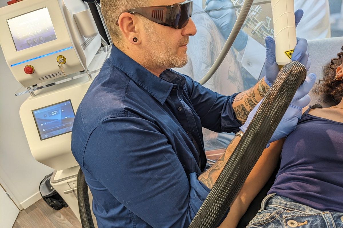Le détatouage au laser, comment ça marche ? Le salon Gemol'ink à Nevers ...