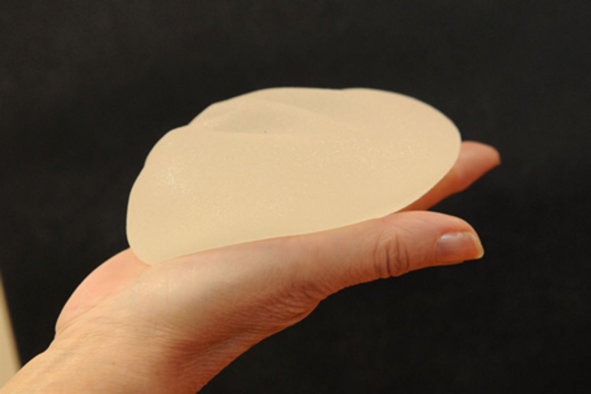 Prothèses PIP : le Limousin aussi s'interroge - Le Populaire du Centre