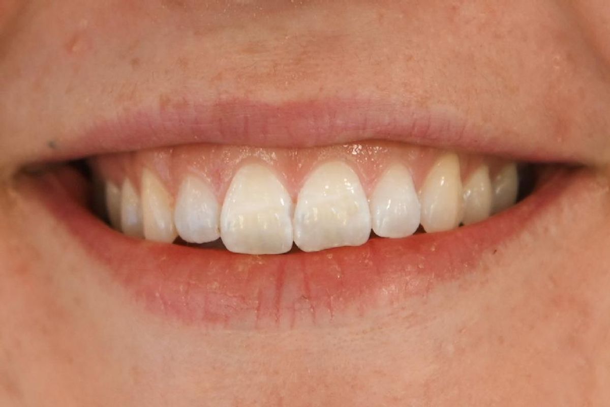 Une conférence sur les dents à Bourbon-l'Archambault - La Montagne