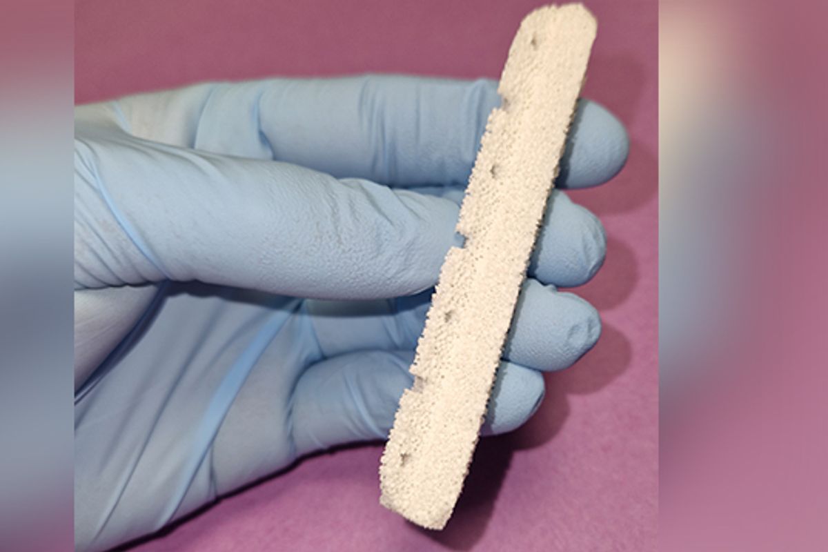 La société de Limoges I.Ceram, lauréate du concours iNov, va recevoir ...